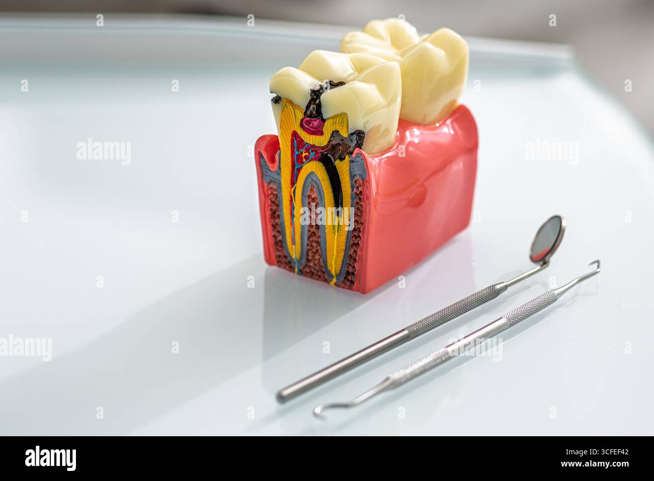 Highlighting cavities hi-res stock photography and images - Alamy
