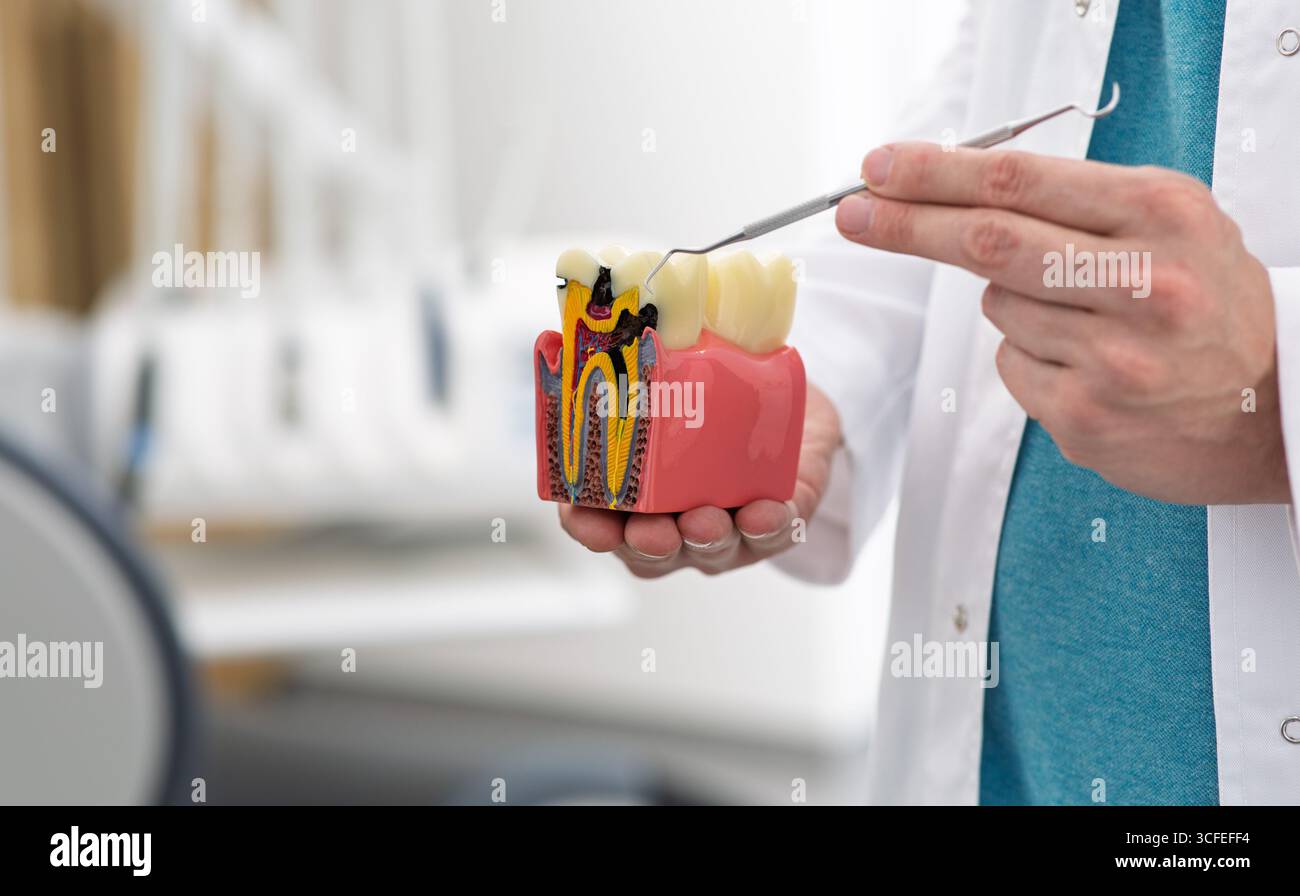 Dental professional demonstrates tooth structure using a model to ...