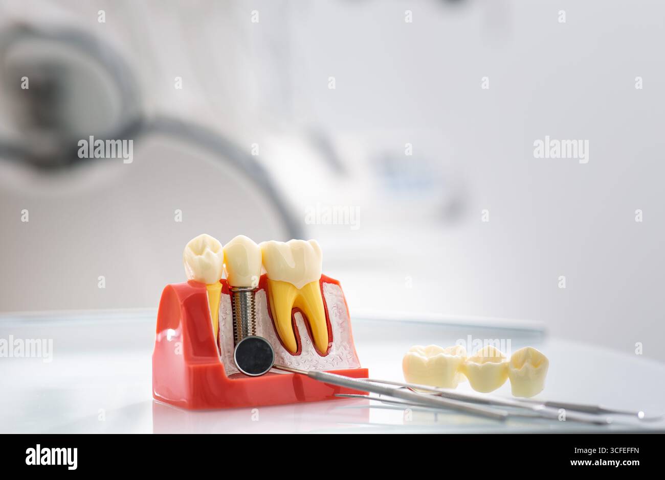 Stomatology concept. Detailed tooth model showcases the layers of ...
