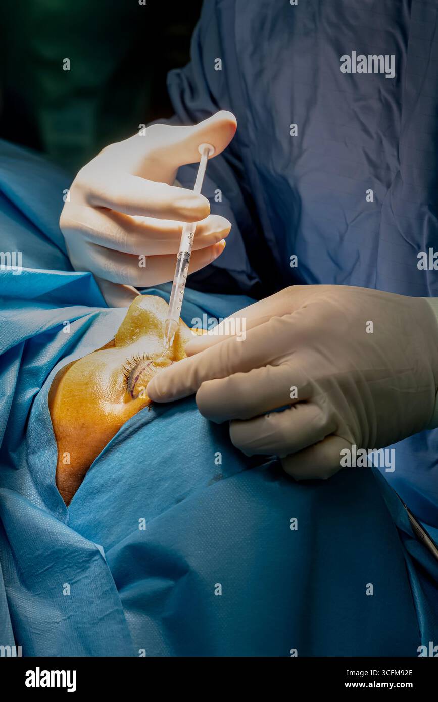Cosmetic procedure for changing the shape of the eyes, lifting and ...