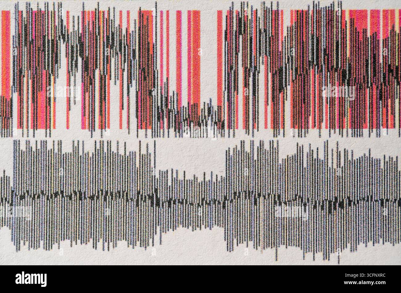 Images charts scientific cardiograms of cardiorespiratory sleep ...
