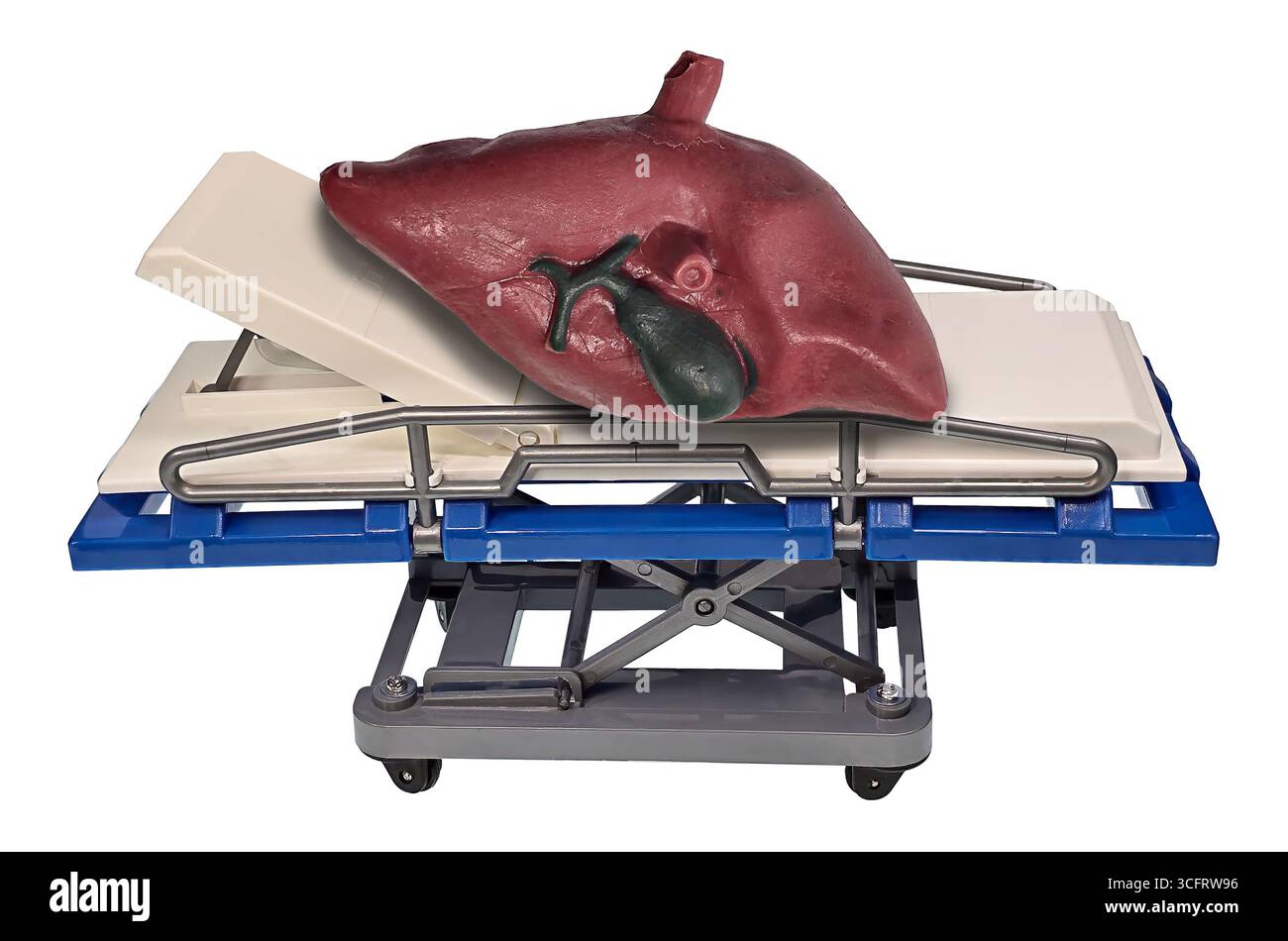 Liver and Gall Bladder on a hospital bed to show care or organ donation ...