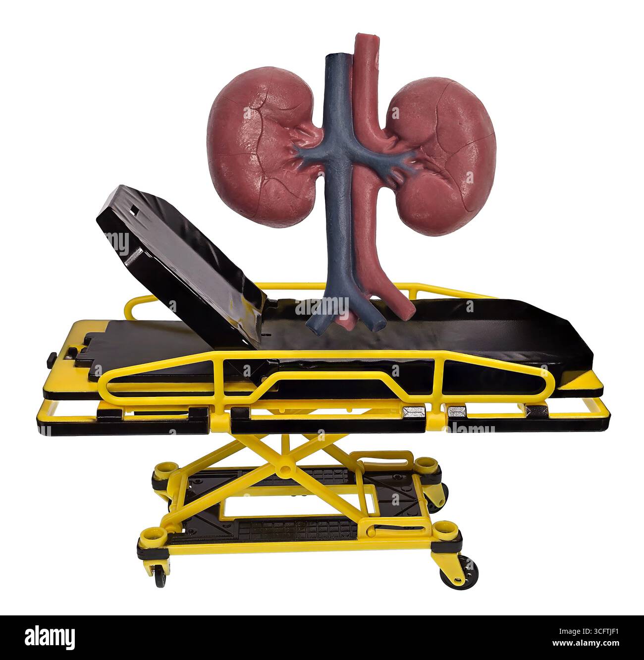 Kidneys filter the blood in the body on a hospital gurney to show care ...
