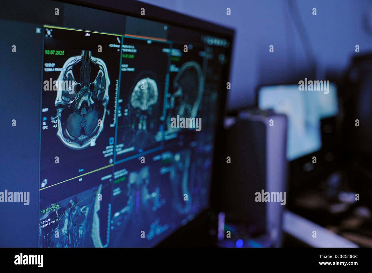 Brain Mri Scans Displaying on Medical Monitor in Hospital Diagnostic ...