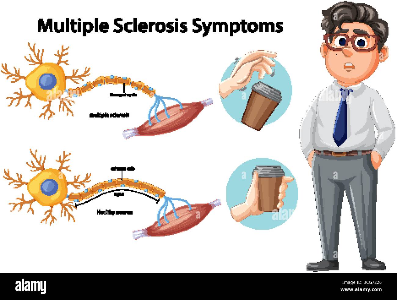 Vector diagram comparing healthy and damaged neurons in multiple ...
