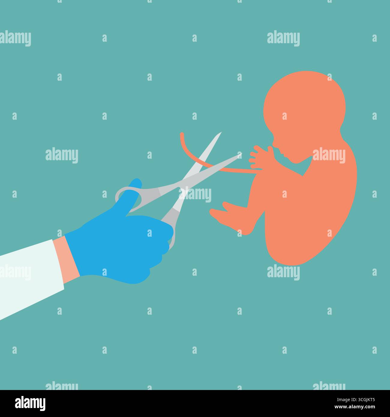 Hand Cutting Newborn Baby Umbilical Cord Cartoon Illustration Stock ...