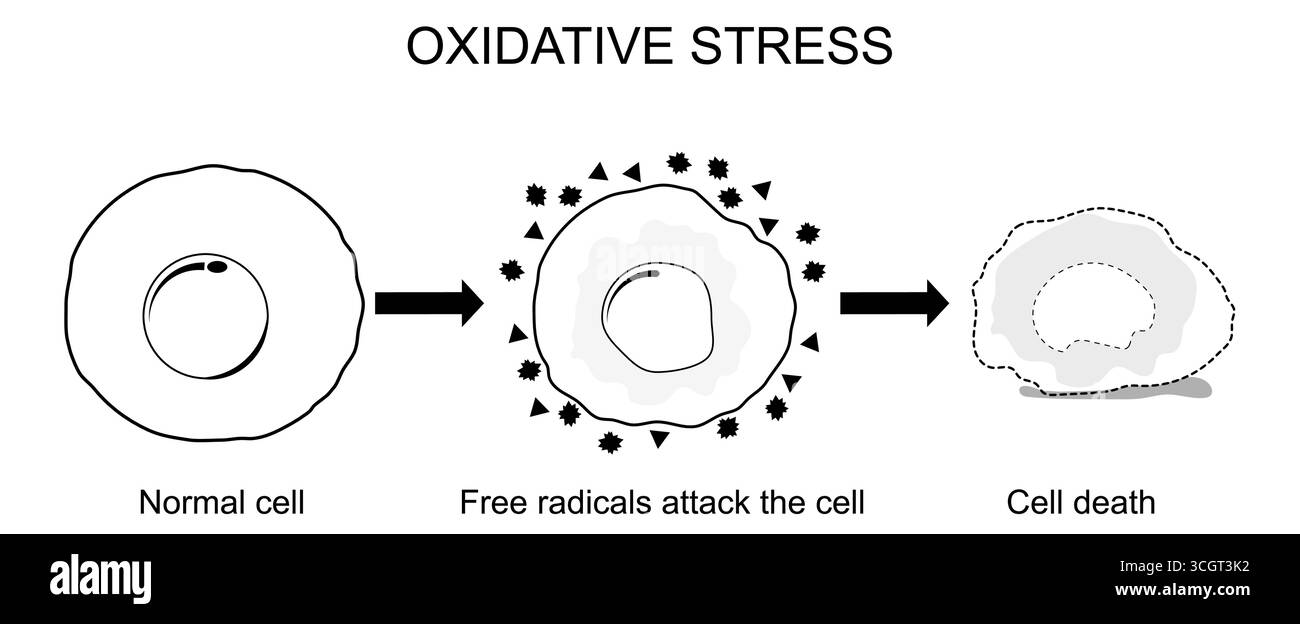 Oxidative stress. Imbalance between the production of free radicals and ...