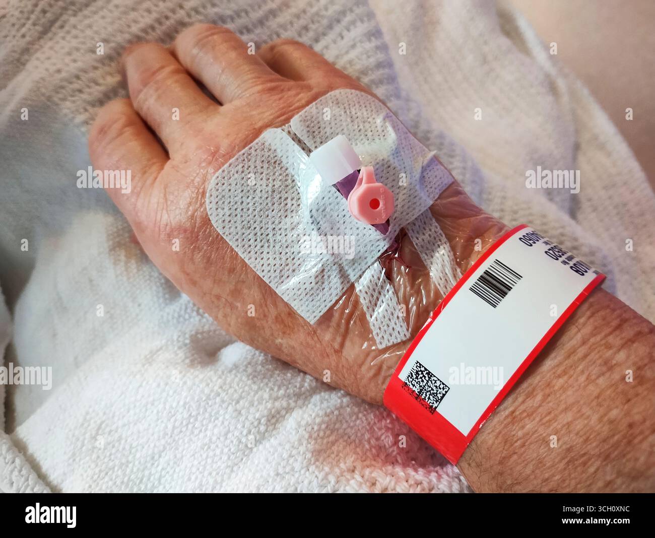 Canula in patients hand hi-res stock photography and images - Alamy