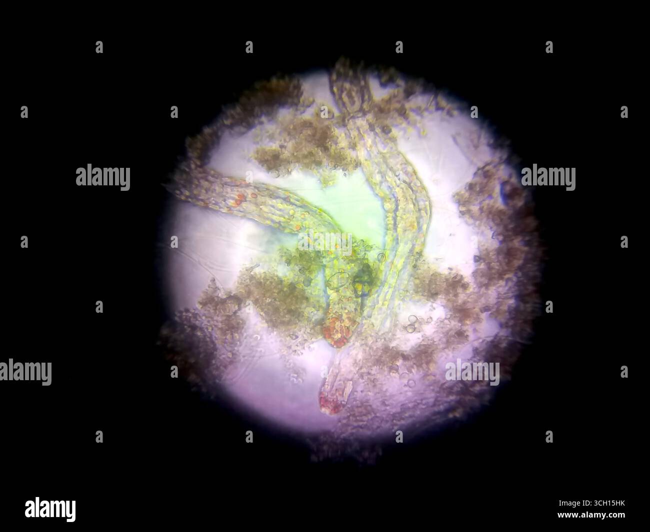 Nematode germs are viewed under a microscope, revealing their unique ...