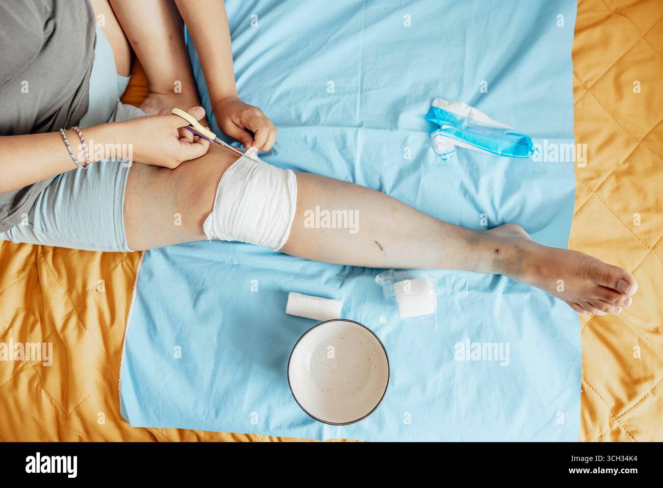 person cutting medical bandage from leg after surgery, home wound care ...