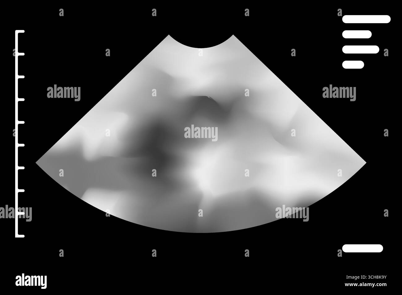 Grayscale ultrasound image revealing intricate anatomical structures ...