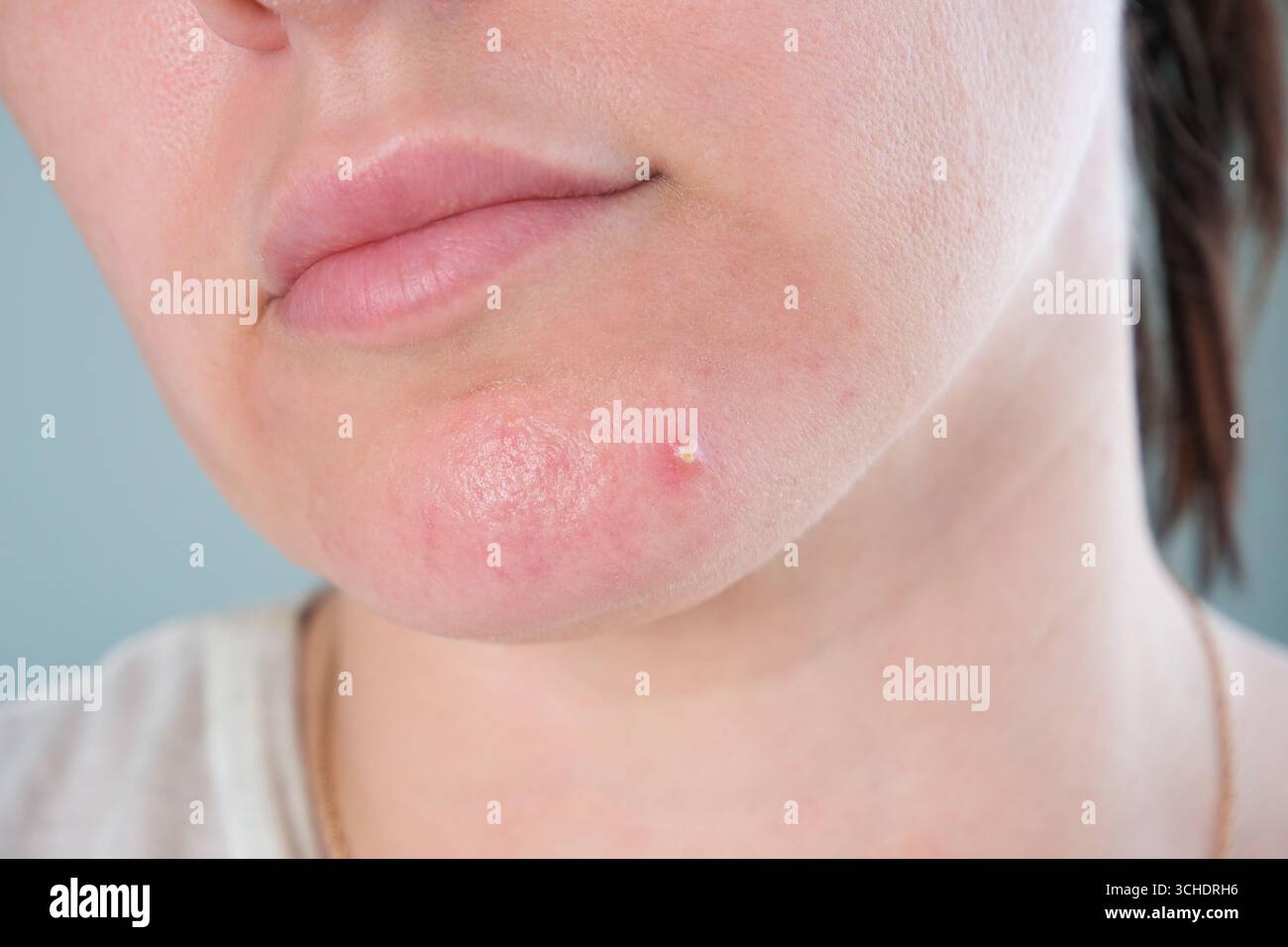 Woman's pores hi-res stock photography and images - Alamy
