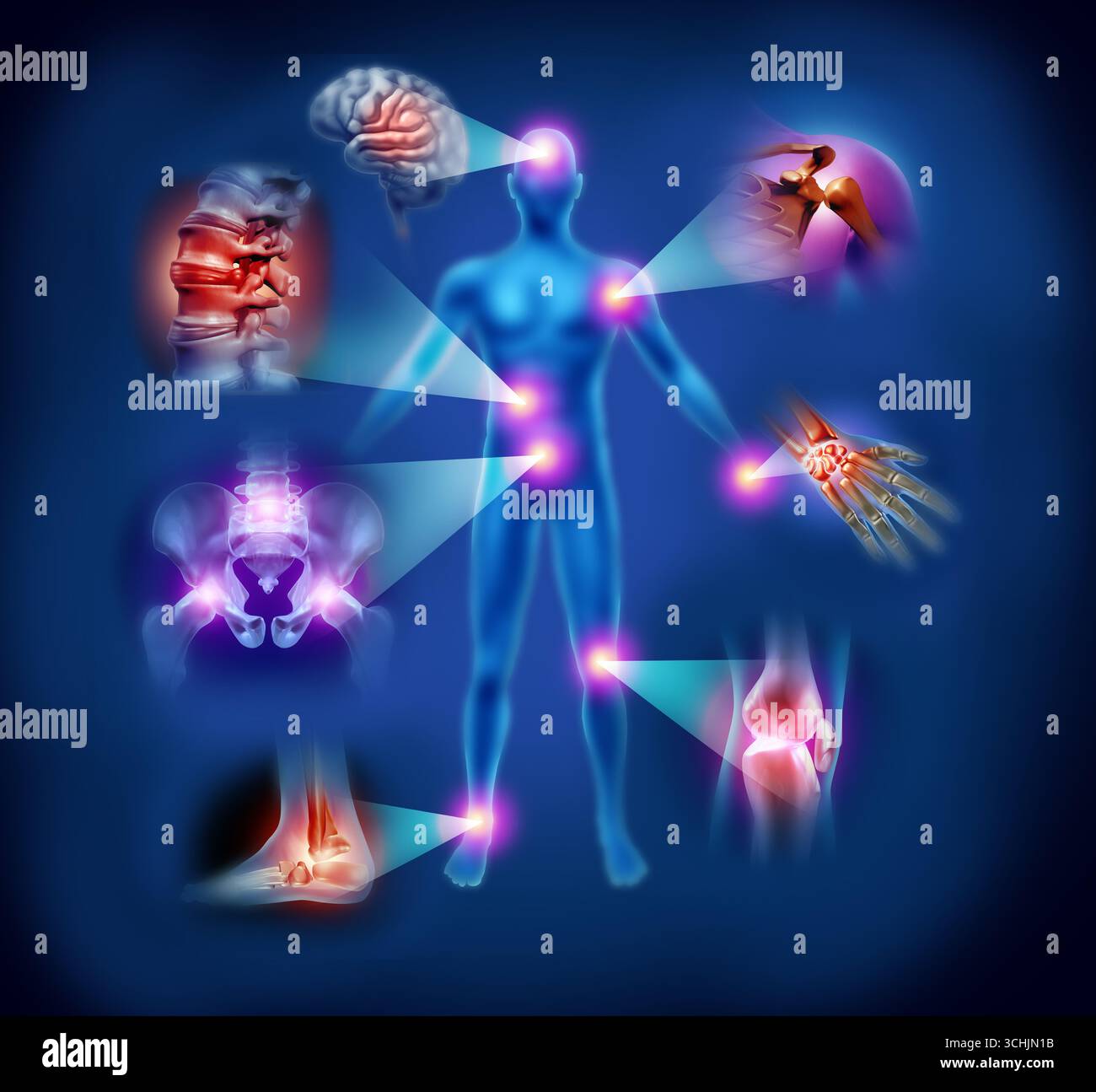 Pain areas hi-res stock photography and images - Alamy