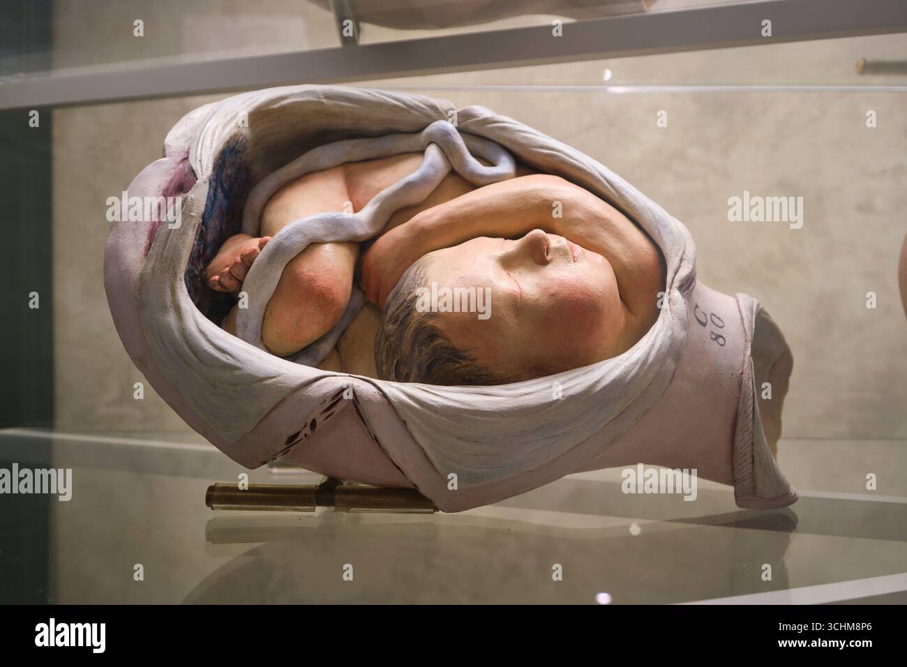 A baby obstetric model. At the uterus, pregnancy gallery, science ...