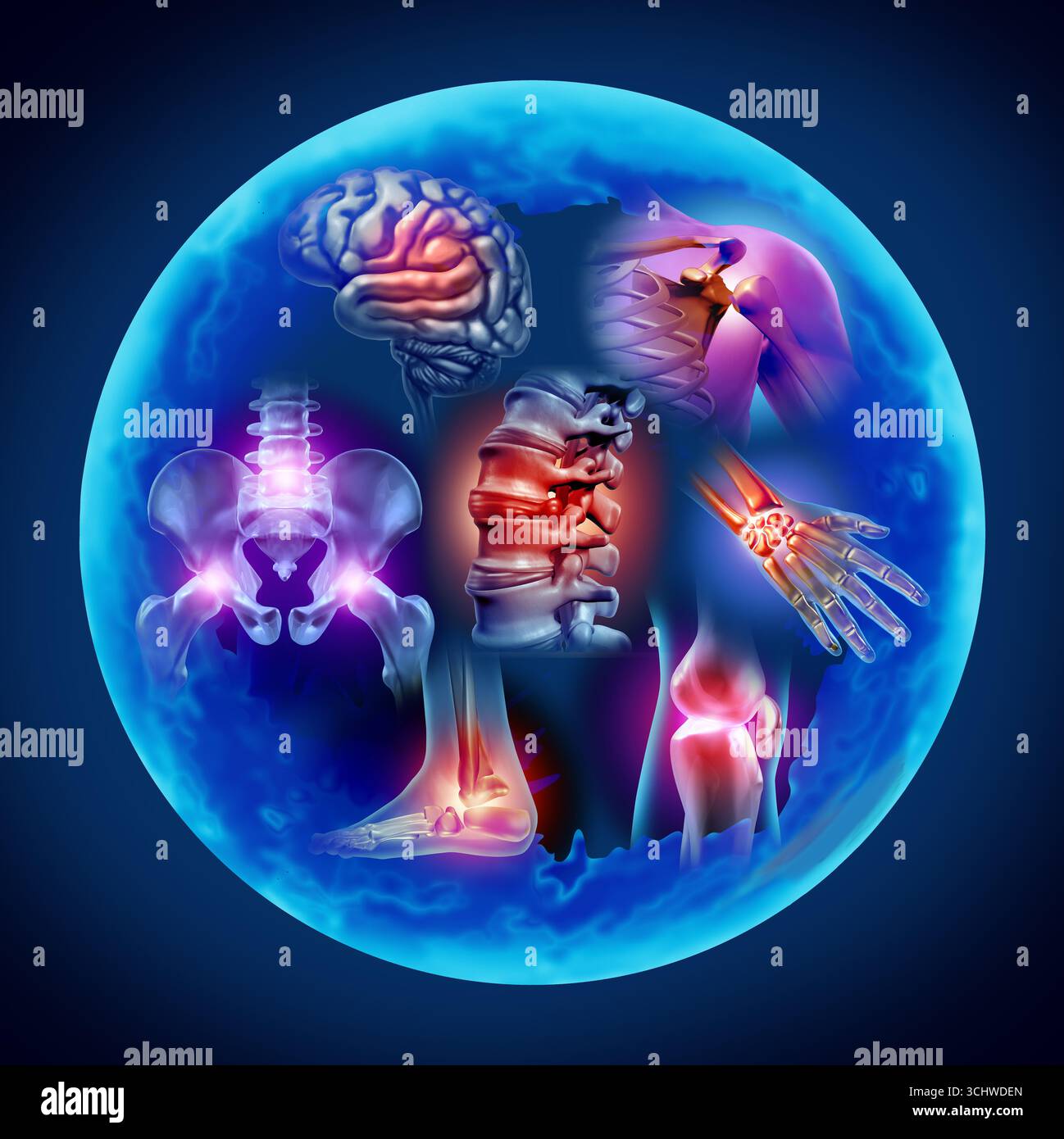 Chronic inflammation in brain hi-res stock photography and images - Alamy