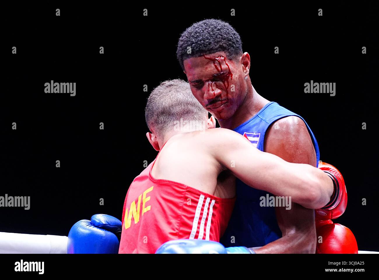 Jorge Cuellar reacts to a cut on on the forehead in the Men's 70kg bout ...