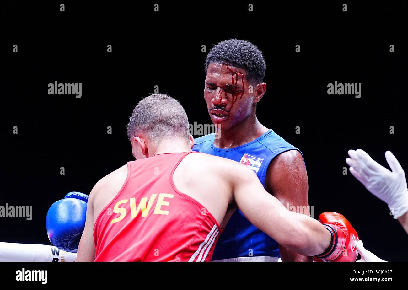 Jorge Cuellar reacts to a cut on on the forehead in the Men's 70kg bout ...