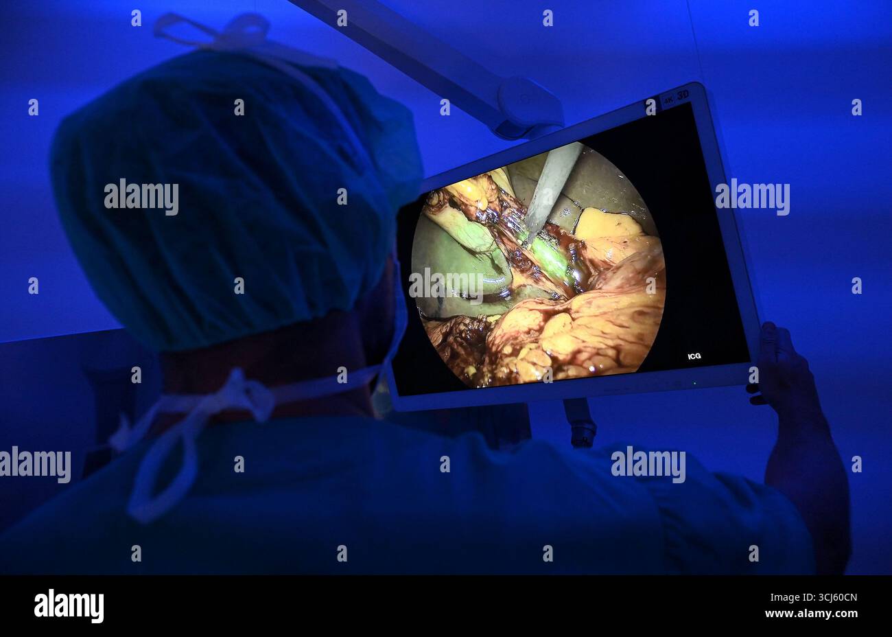 Integrated Operation Room (IOR) is pictured during offical presentation ...