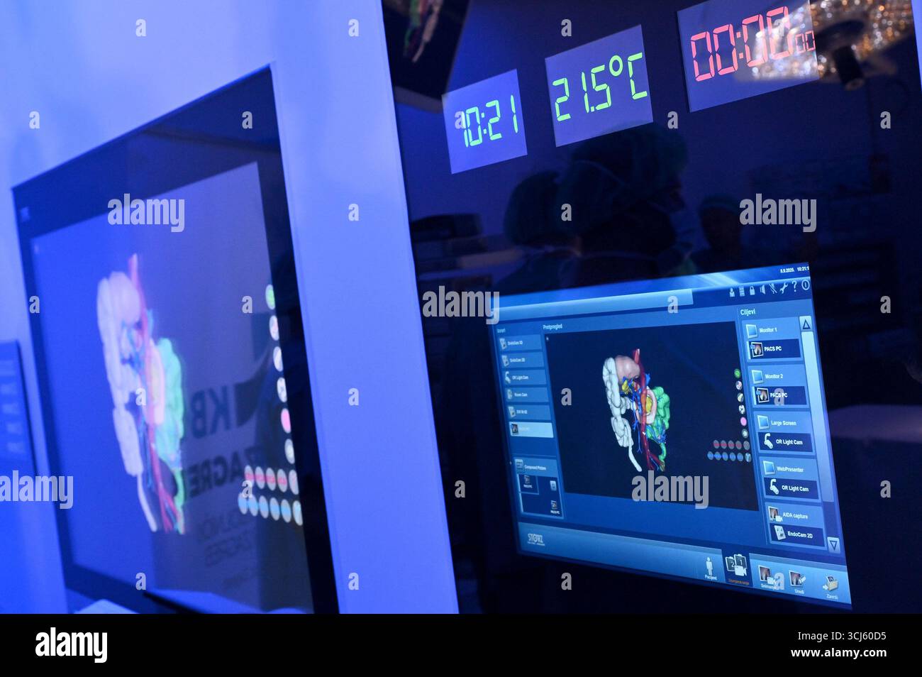 Integrated Operation Room (IOR) is pictured during offical presentation ...