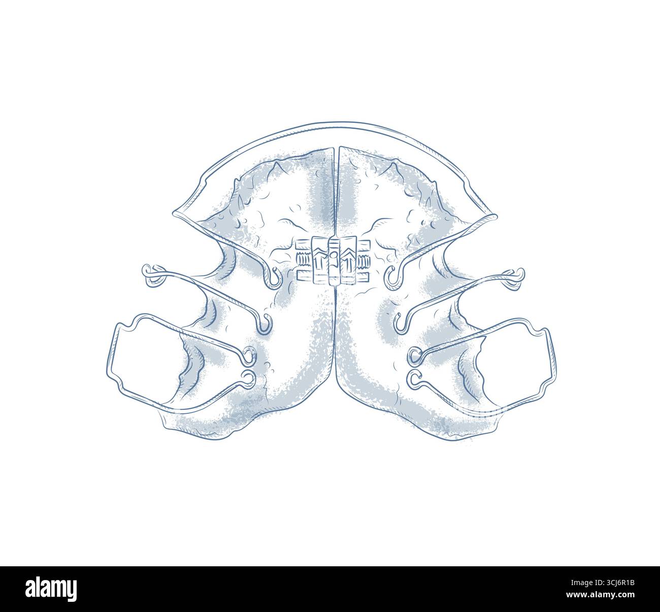 Orthodontic align teeth plate illustration drawing in graphic style ...