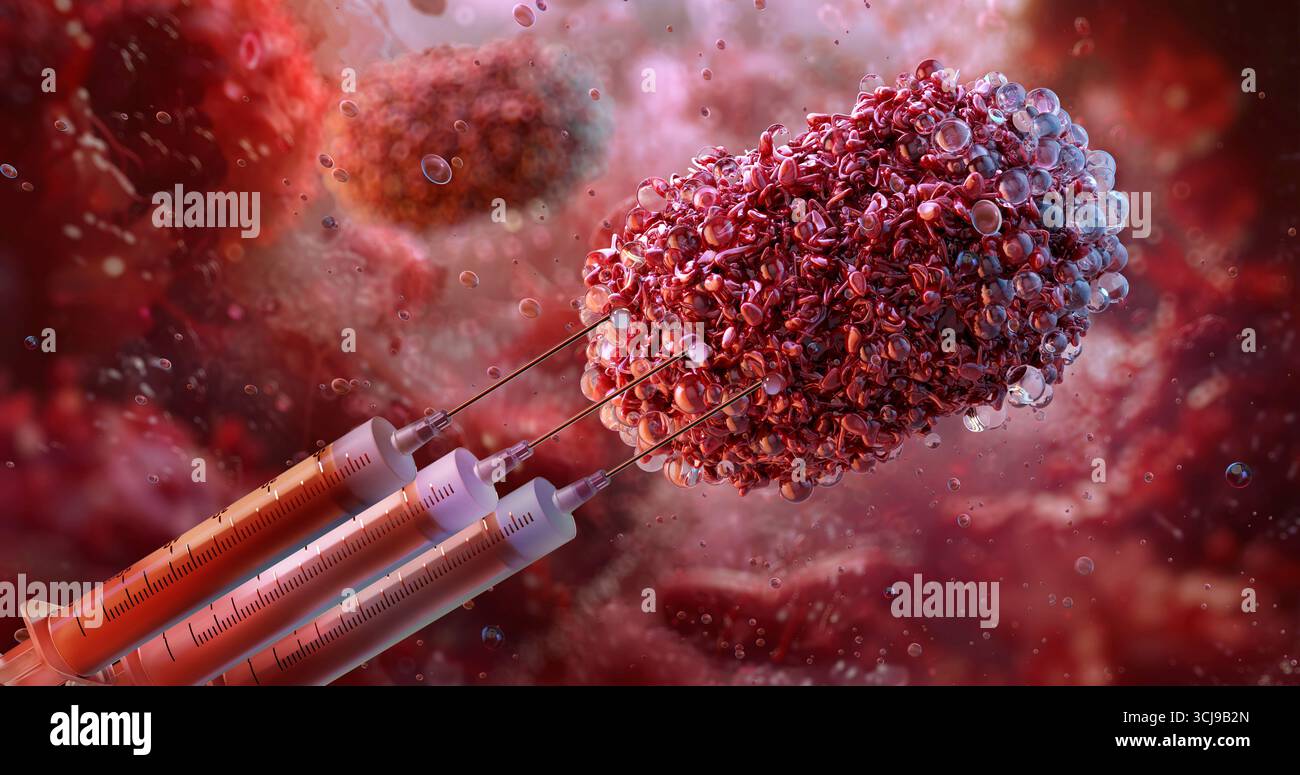 Conceptual illustration of a vaccine for the Mpox virus. Previously ...