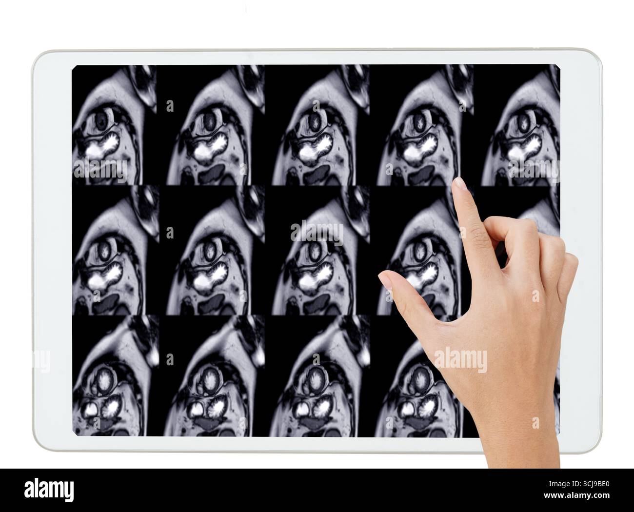 Mri perfusion hi-res stock photography and images - Alamy