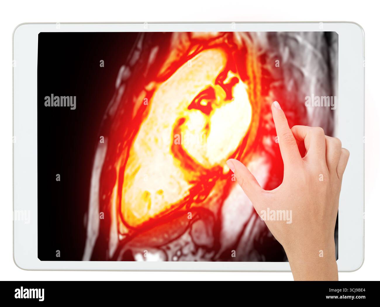 Detailed MRI heart stress test displayed on a tablet, with a hand ...