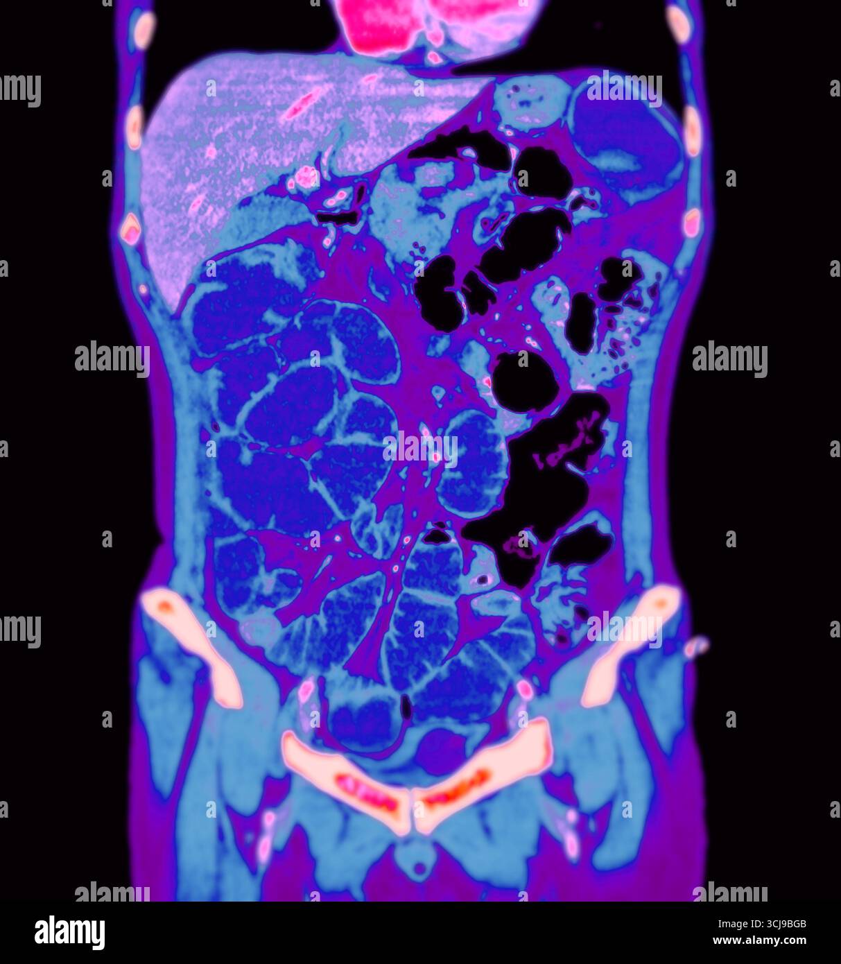 High-resolution abdominal CT image highlighting vascular and organ anatomy with intense color ...