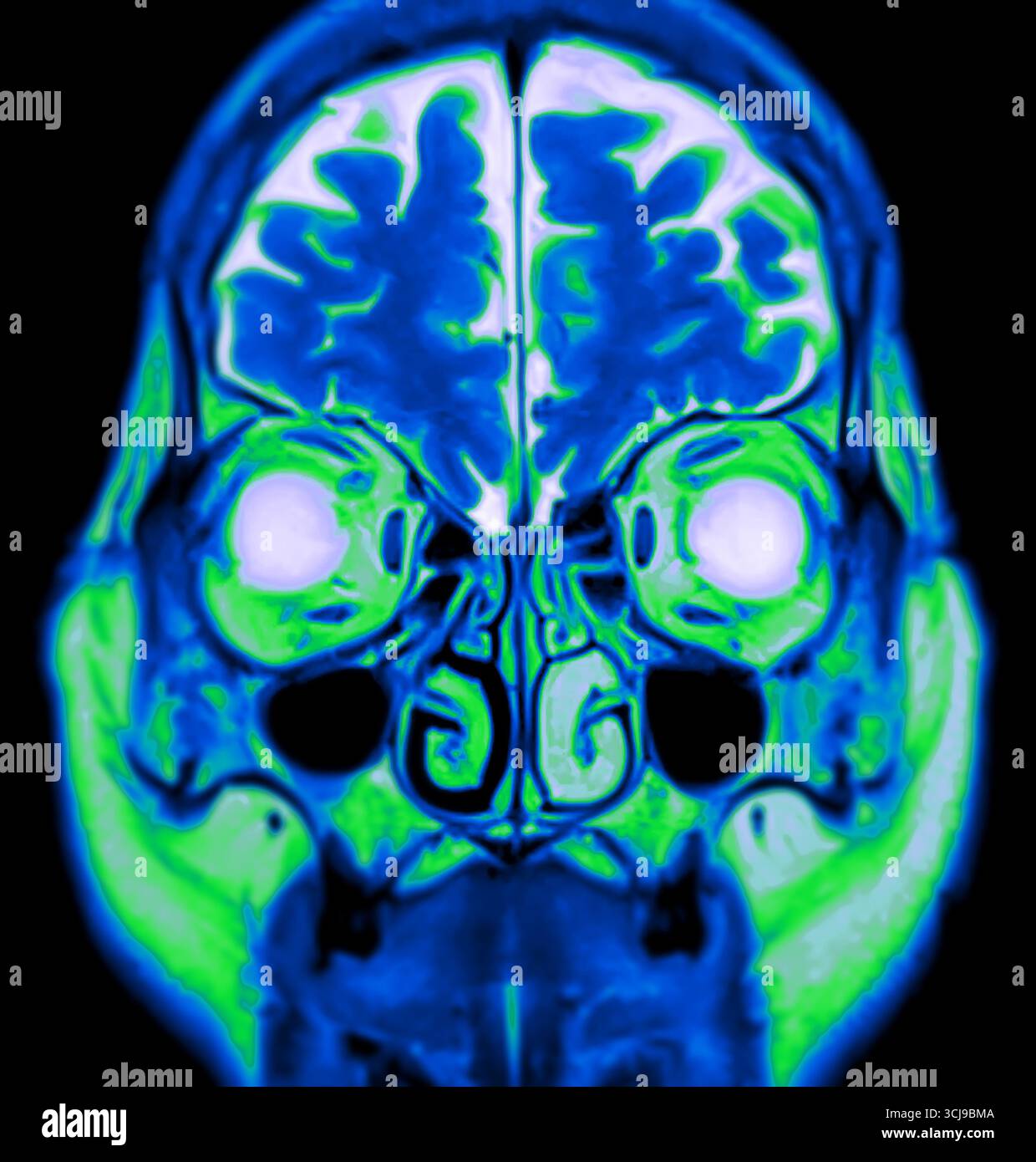 The color-enhanced MRI reveals the brain’s anatomy in striking hues. It ...