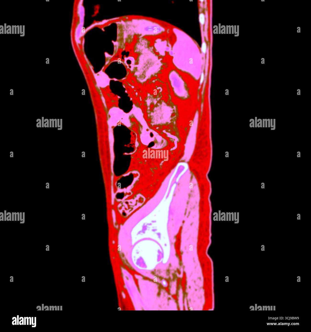 Fluoroscopic footage of a barium swallow test showing real-time ...