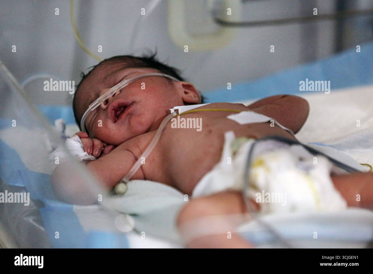 Newborn Palestinian baby Hamza al-Rubai receives medical care at Al ...