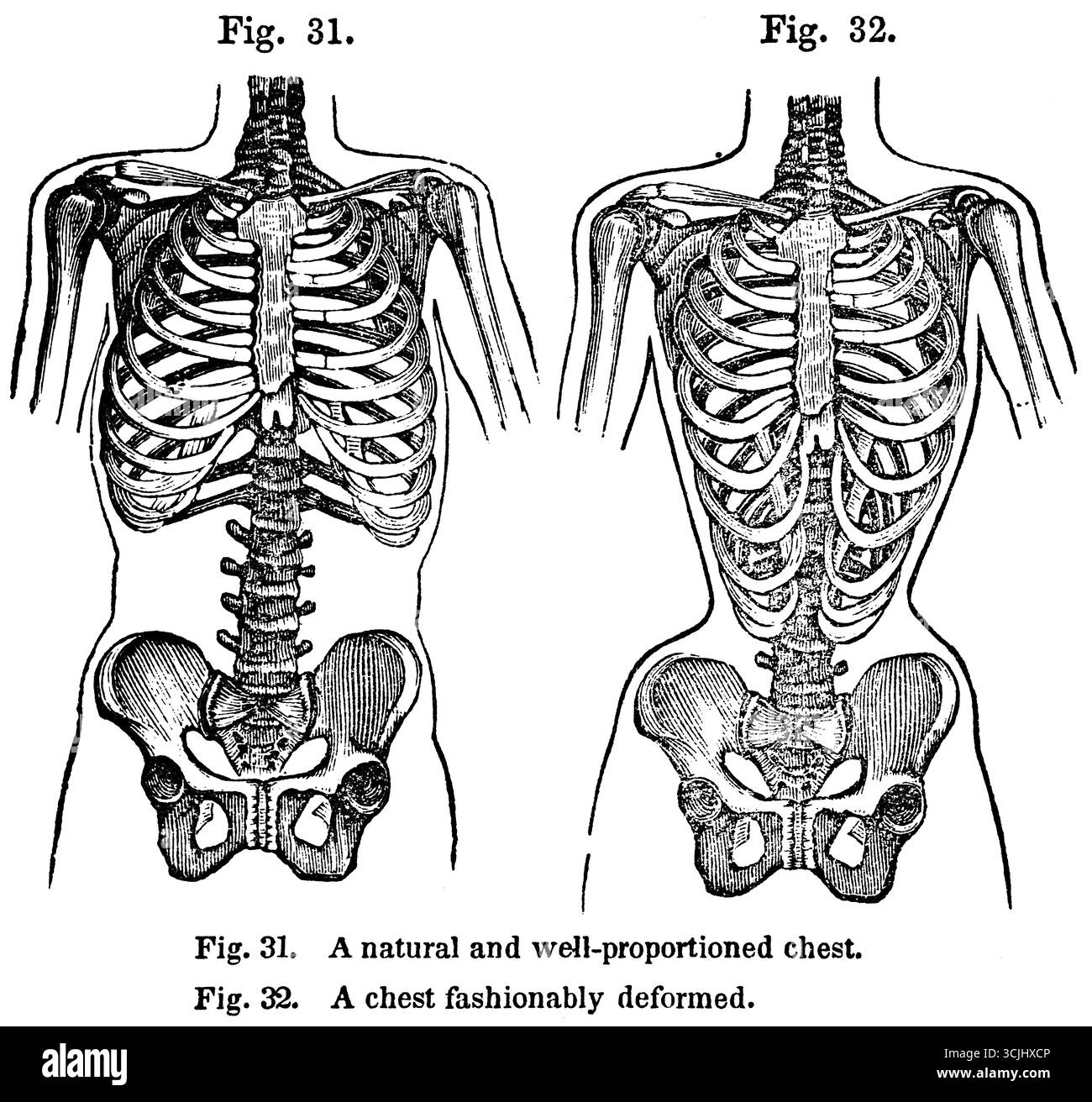 Anatomy of a chest, natural and well-proportioned chest (Fig.31) and ...