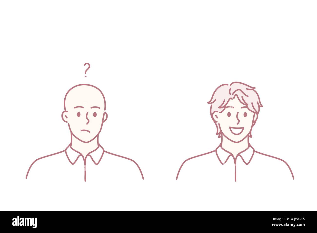 Hair loss and baldness concept. Faces of young completely bald man with ...