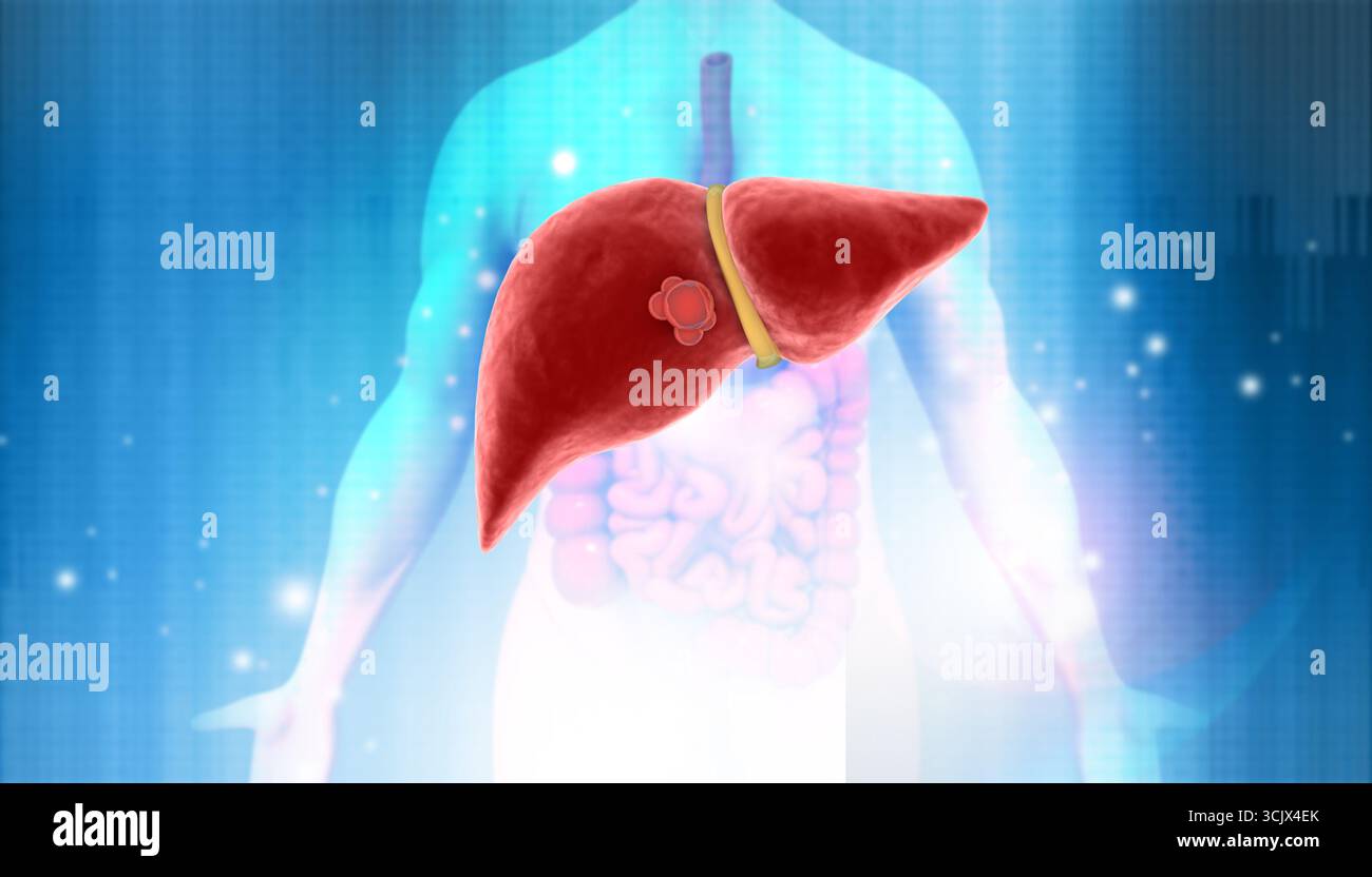 Man with Damaged human liver on medical background. 3d illustration ...