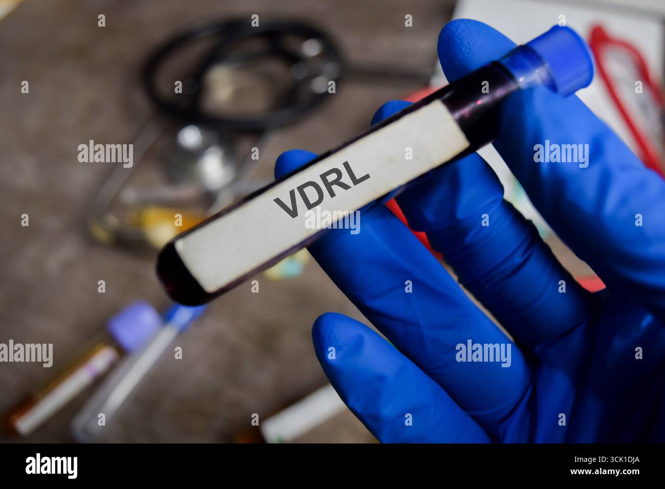 VDRL vaccination drug in blue gloved hands. Medical concept Stock Photo ...
