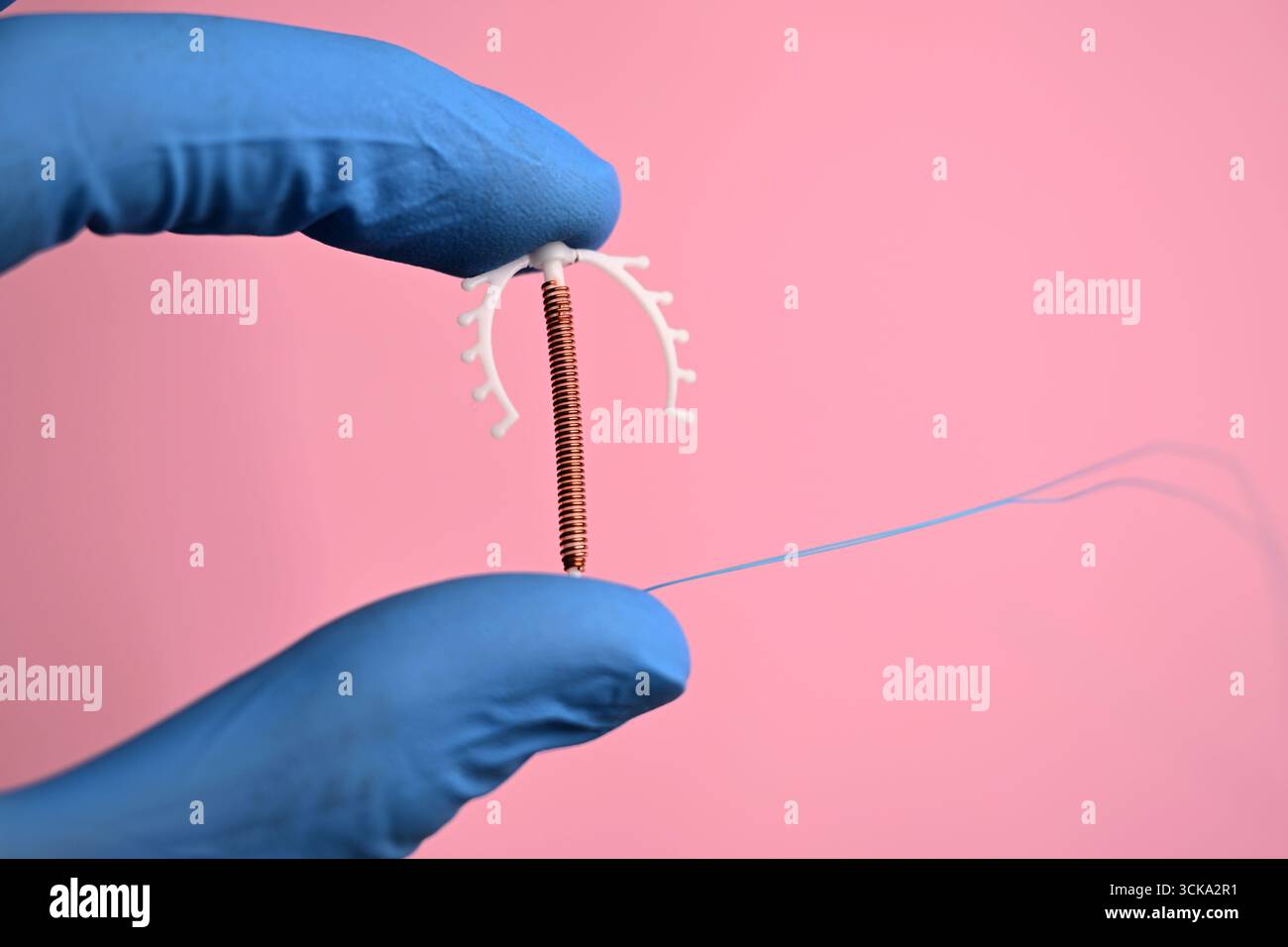 A Copper IUD in Melbourne, Wednesday, September 10, 2025. (AAP Image ...