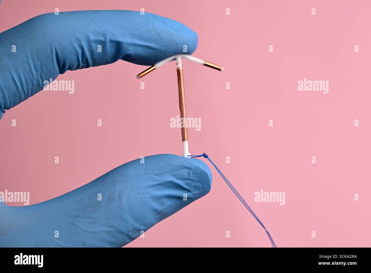 A Copper IUD in Melbourne, Wednesday, September 10, 2025. (AAP Image ...