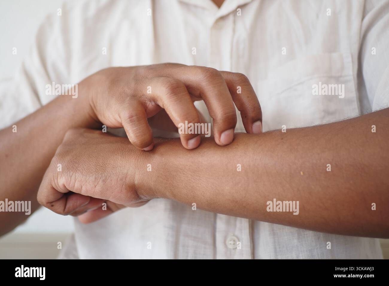 Man scratching arm while sitting indoors in a light setting Stock Photo ...