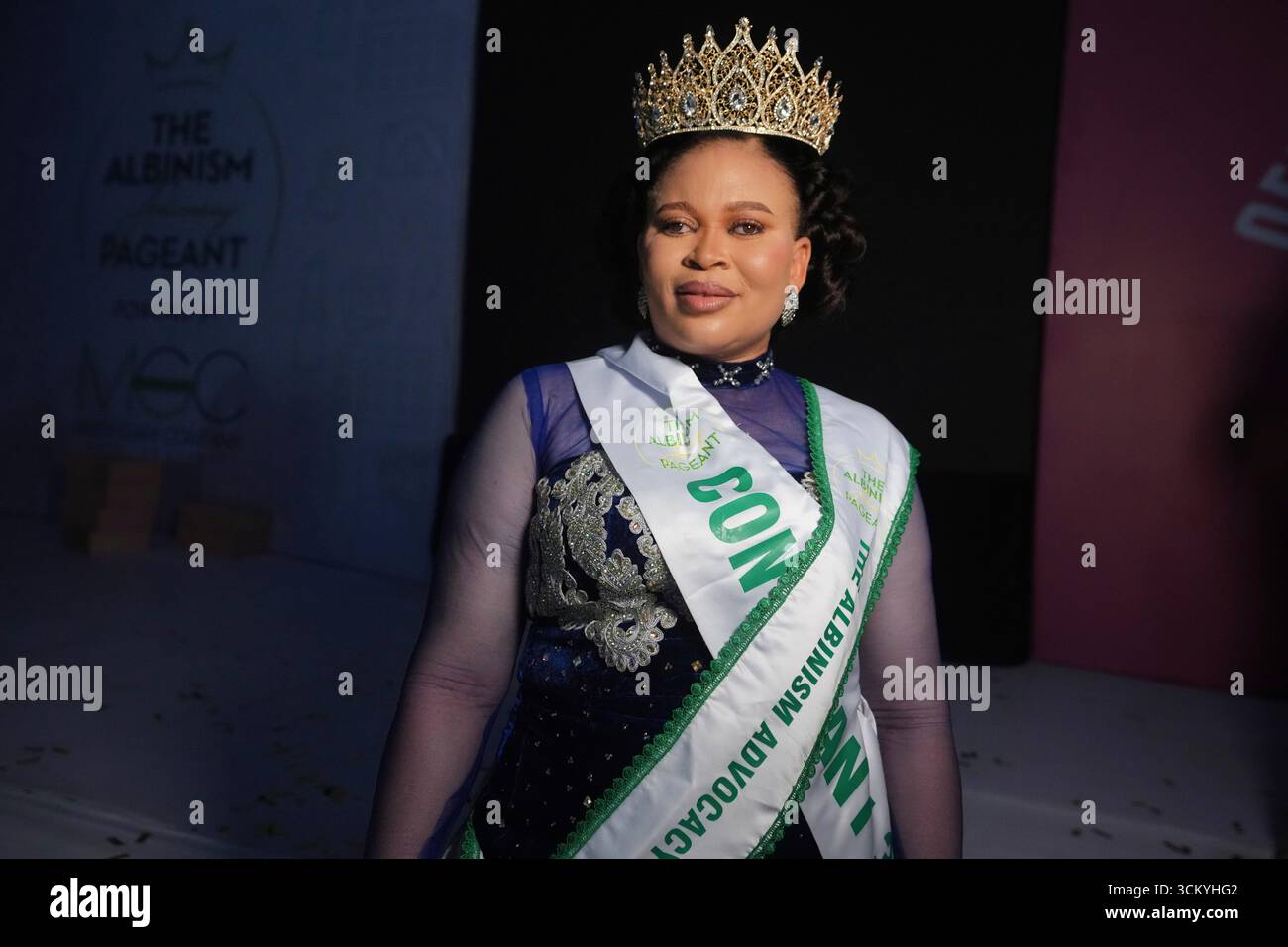 Anita Chidiebube Dike, the winner of the Albanism Advocacy Pageant ...