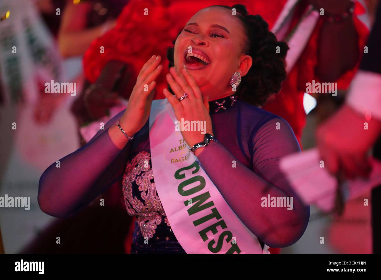 Anita Chidiebube Dike, a contestant with Albanism, reacts as she was ...