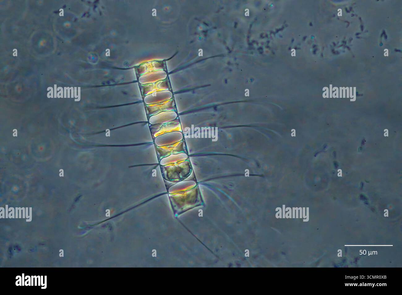 Diatom from the genus Chaetoceros. Collected in surface plankton sample ...