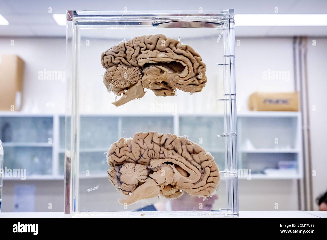AMSTERDAM - Brain. Netherlands Brain Bank (NHB). The Brain Bank ...