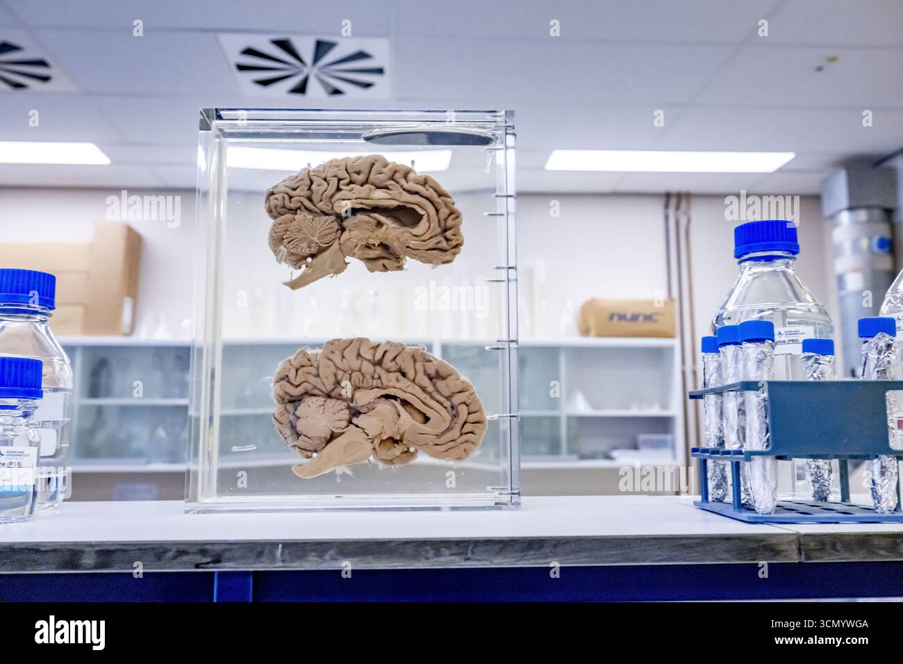 AMSTERDAM - Brain. Netherlands Brain Bank (NHB). The Brain Bank ...
