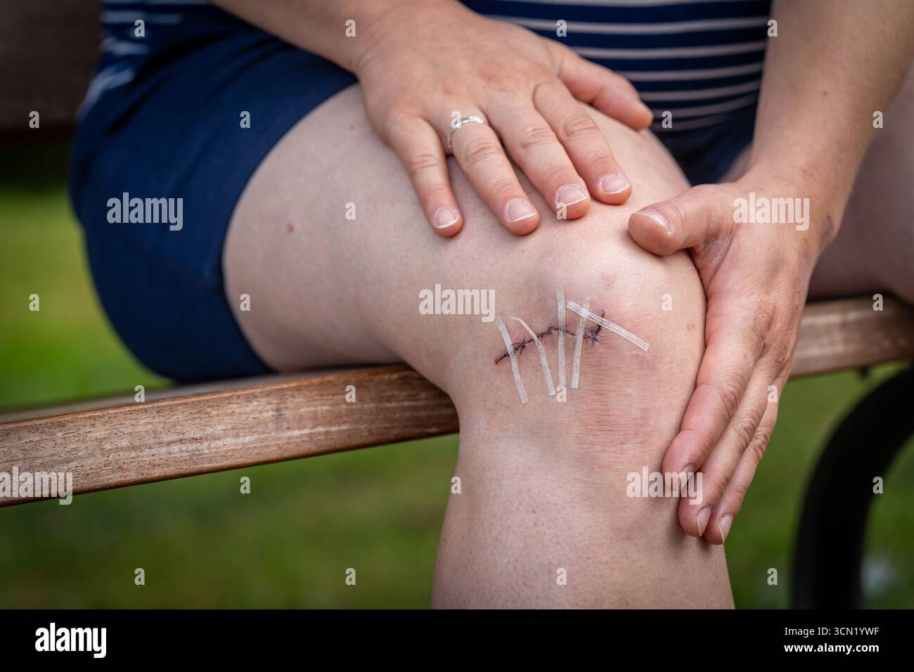 Laceration wound hi-res stock photography and images - Alamy