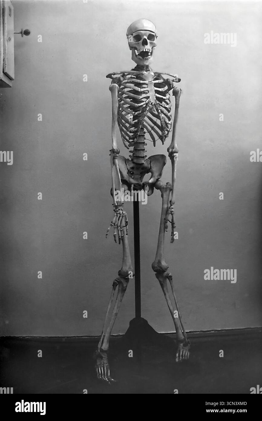 A historical photograph from the 1970-80s, showing an anatomical model ...