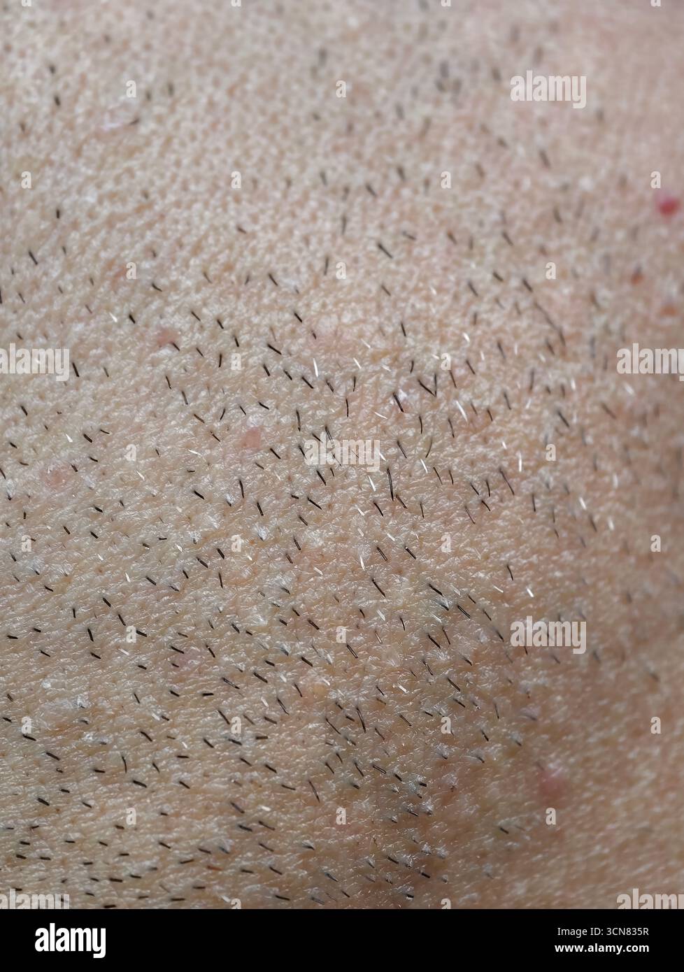The skin of the man's, face with stubble and flaky skin, sparse gray ...