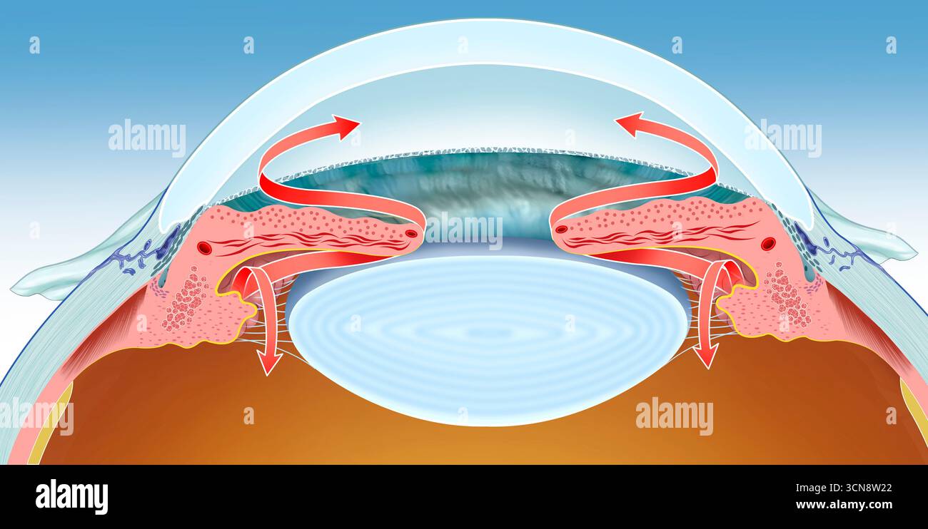 Aqueous humour drainage in glaucoma hi-res stock photography and images ...