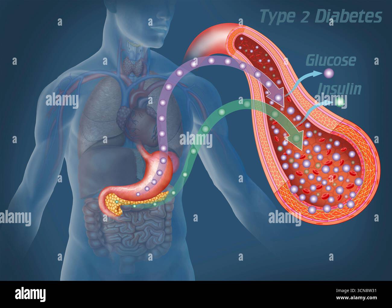 Illustration of a human figure on a blue background showing an artery ...