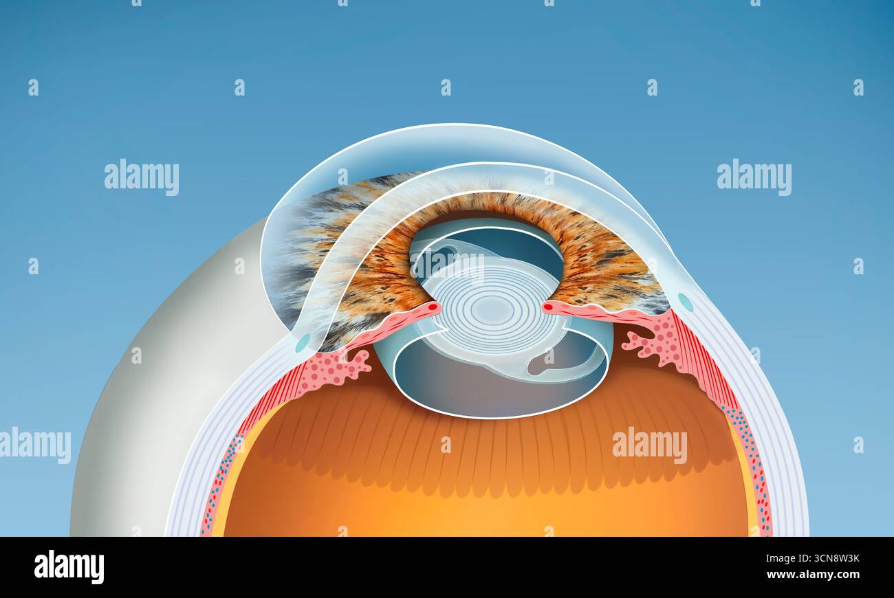 Intraocular lens implantation and replacement hi-res stock photography ...