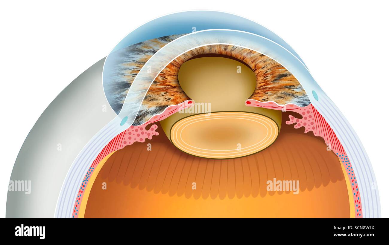 Lens opacity with cataracts hi-res stock photography and images - Alamy